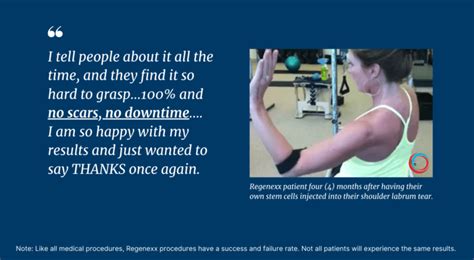 Shoulder Labrum Surgery Alternative For Faster Recovery