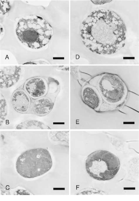 Figure 3 From Role For Yeast Inhibitor Of Apoptosis Iap Like Proteins