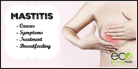 Mastitis Causes Symptoms Treatment And Breastfeeding