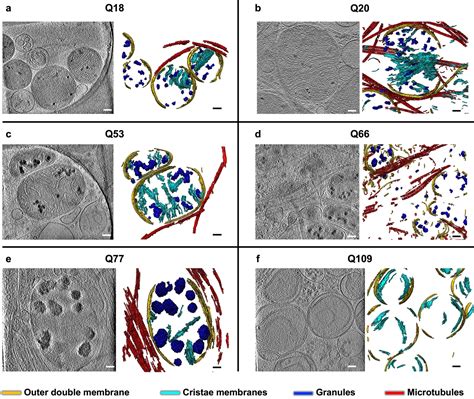Cryo Em For Biological Tissues Structure Characterization Service