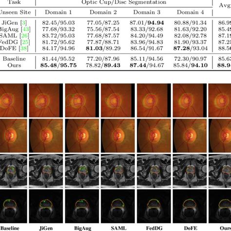Dice Coefficient Of Different Methods On Fundus Segmentation Task Download Scientific