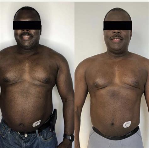 Weight Loss Injections In Nyc Medical Weight Loss In New York City