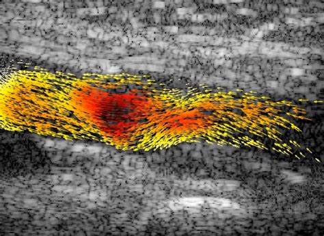 Projectile Vector Doppler Imaging