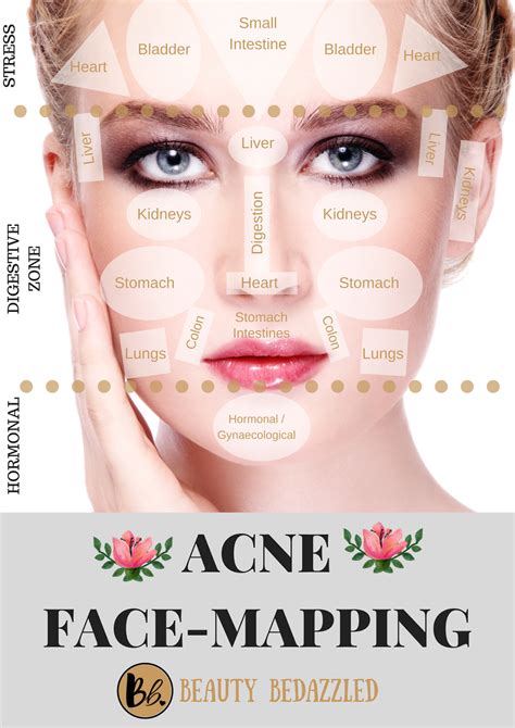 Acne Face Mapping What Does Your Acne Tell You In 2024 Face