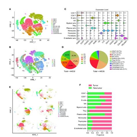 Tumor Environment In Thyroid Cancer T Sne Visualization Of Tumor