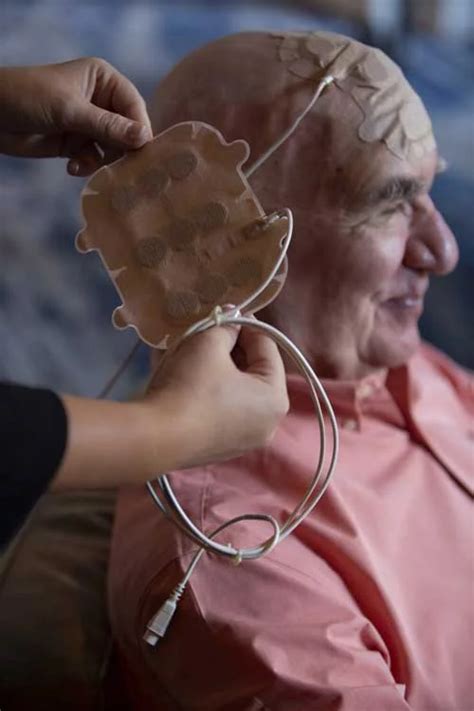 Orbitozygomatic Craniotomy For Complex Skull Base Surgery