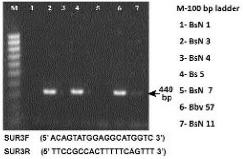 Pcr Amplification Of The Antibiotic Biosynthetic Gene Surfactin Of