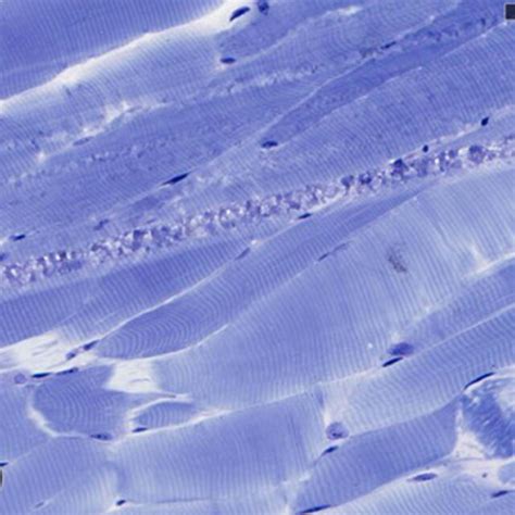 An Image Of Skeletal Muscle At 40x Magnification On Pathcore Flow