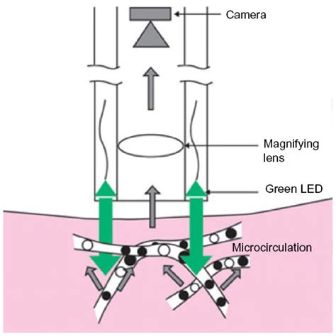 Non Invasive Imaging Of Microcirculation A Technology Review Mder