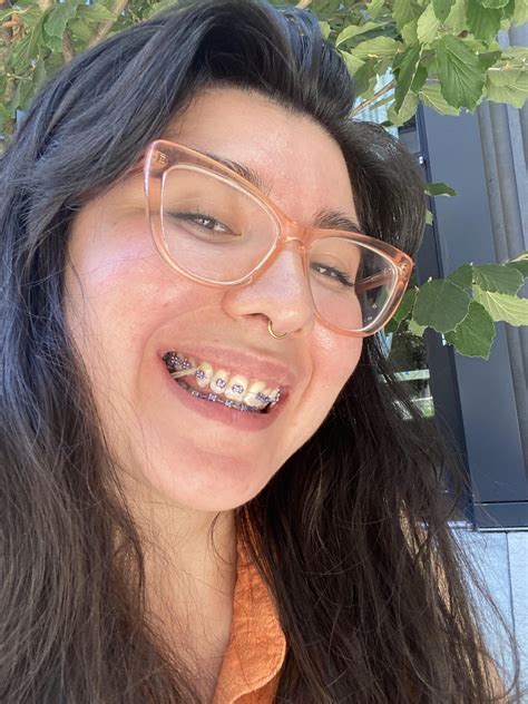 Anyone Have One Of These V Loop Retainers Rbraces