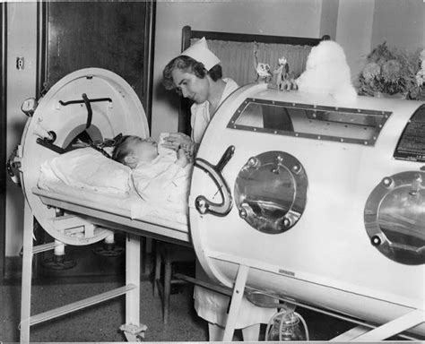 Breath Is Life The Fascinating History Of The Iron Lung The Wisdom Daily