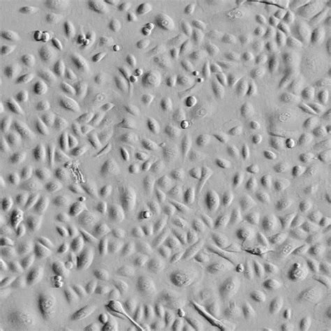 Human Conjunctival Epithelial Cells Innoprot Ocular Cell System