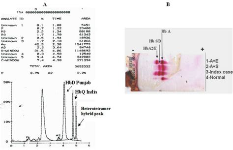 Comparison Of Two Analytical Methods Electrophoresis And 55 Off