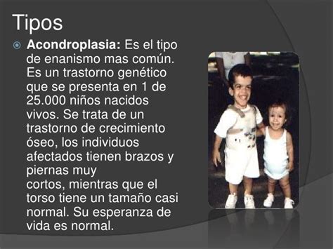 Enanismo