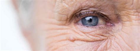 Glaucoma The Leading Cause Of Irreversible Blindness In Canada