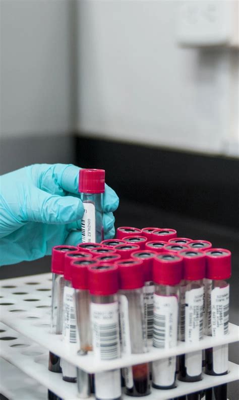Hpv Test At Home In Dubai 100 Confidential Vesta Care