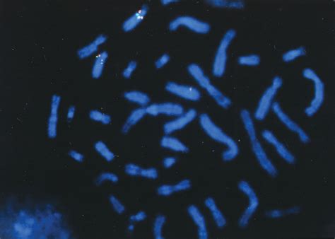 Human Genetic Disease Sex Linked Inheritance Britannica