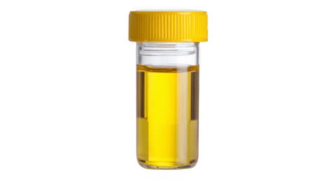 Urine Sample Pngs For Free Download