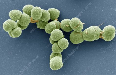 Halobacterium Halobium Pdf Biotechnological Potential Of Halobacteria