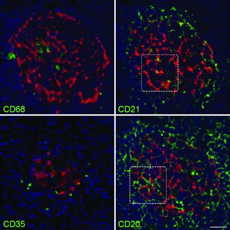 Mesenteric Lymph Node Double Staining With Kfdv And Cd3 Cd20 Cd21 Download Scientific