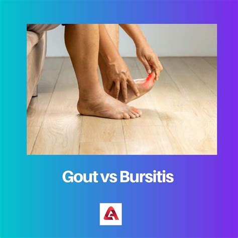 Gout Vs Bursitis Difference And Comparison