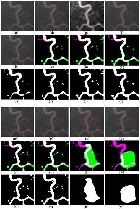 A New Active Contour Medical Image Segmentation Method Based On