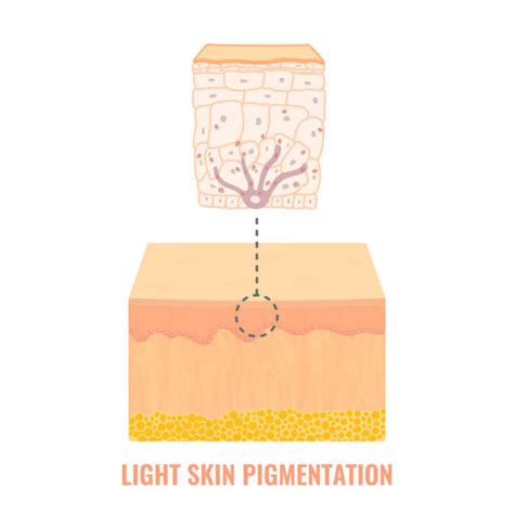 40 Hyperpigmentation Diagram Stock Illustrations Royalty Free Vector