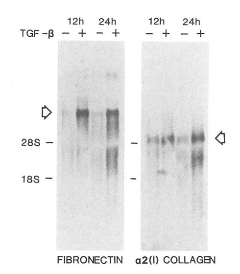 Figure 1 From Regulation Of Fibronectin And Type I Collagen Mrna Levels By Transforming Growth