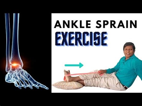 5 Easy Ankle Sprain Exercises To Heal It Fast
