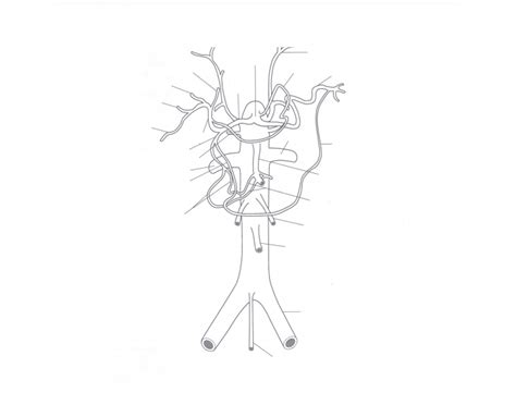 Branches Of Abdominal Aorta Cross Sectional Anat Quiz