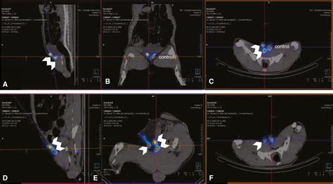 Lymphatic Imaging For Functional Analysis Of Transplanted Lymph Node