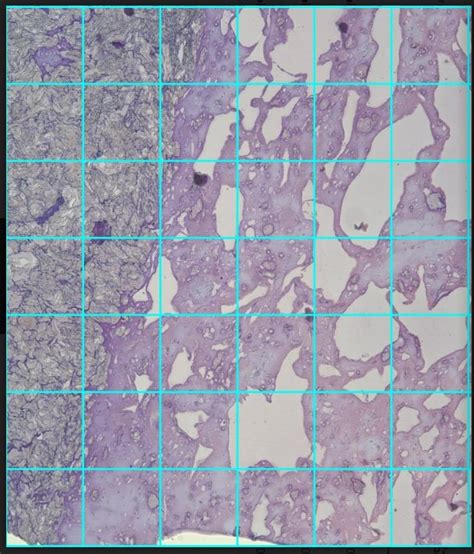 Solved Classify The Tissues Under Each Intersection Of Lines