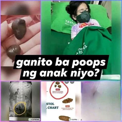 Charry Raising Awareness To All Mommies 📌 Nahihirapan Ba Dumumi Ang