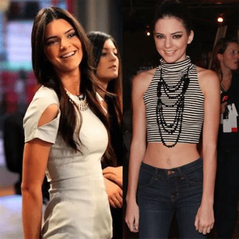 Cómo Kendall Jenner Logró Perder 20 Libras De Peso En 2024 Sus Mejores