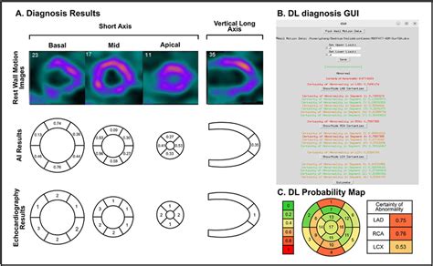Interpretation Of Spect Wall Motion With Deep Learning Journal Of