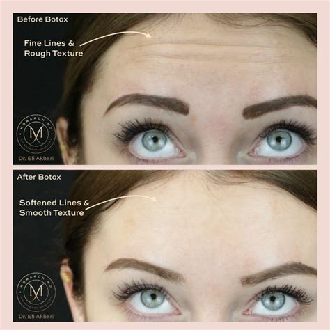 Gallery Monarch Md And Hair Lab Md