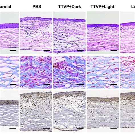A Hande Staining Scale Bar 100 μm B Masson Staining Scale Bar