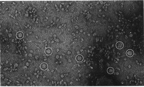 Electron Micrograph Of Methyl Reductase Showing Supramolecular