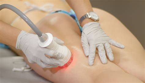 Cellulite Reduction Ultimate Body Contour