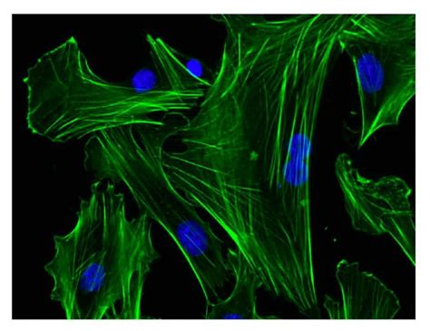 Cytoskeleton The Muscle And The Bone Of A Cell Definition Structure Function And Biology