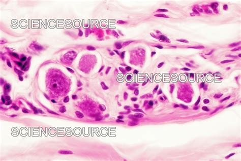 Parasympathetic Ganglion Under A Micro Stock Image Science Source