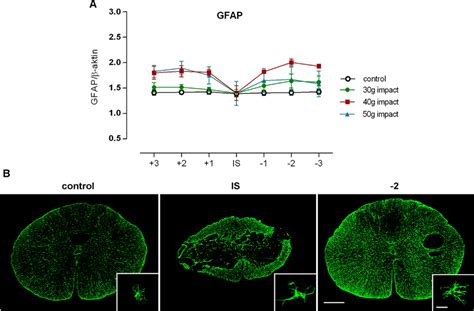 Expression Of Gfap Considered As A Highly Specific Marker Of