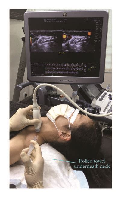 Procedure For Cervical Nerve Root Hydrodissection Patient Positioning Download Scientific