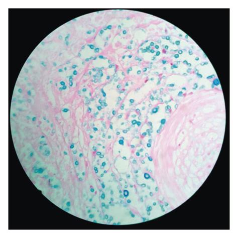 A Periodic Acid Schiff Pas B Alcian Blue And C Colloidal Iron