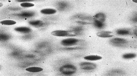 Sickle Cell Detection Object Detection Dataset And Pre Trained Model By