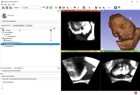 3d Ultrasound Dicom Import Error Reference Image In Series Does Not Contain Geometry
