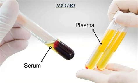 Serum Vs Plasma A Dossier Make My Health Well