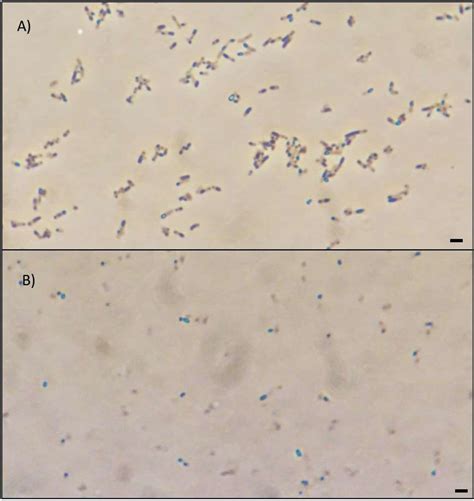 E Coli Under Light Microscope