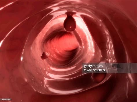 Colon Polyps Artwork High Res Vector Graphic Getty Images