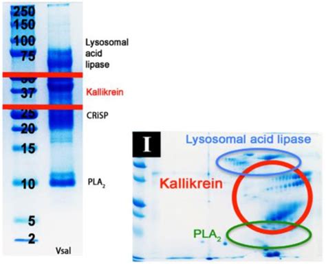 Proteomic Analyses Show The Diversity Of Components Present In The